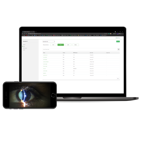 Remidio PSL D20 | Hand Held Portable Slit Lamp